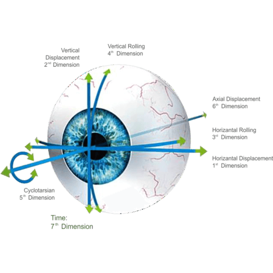 SMART Trans PRK 準分子 - 良視眼科診所